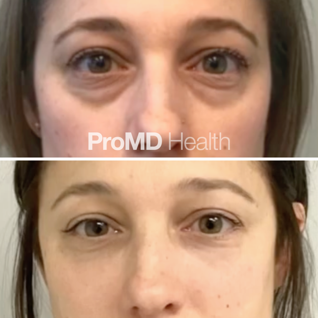 Body Treatments - ProMD Health