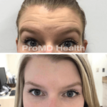 Connect - ProMD Health