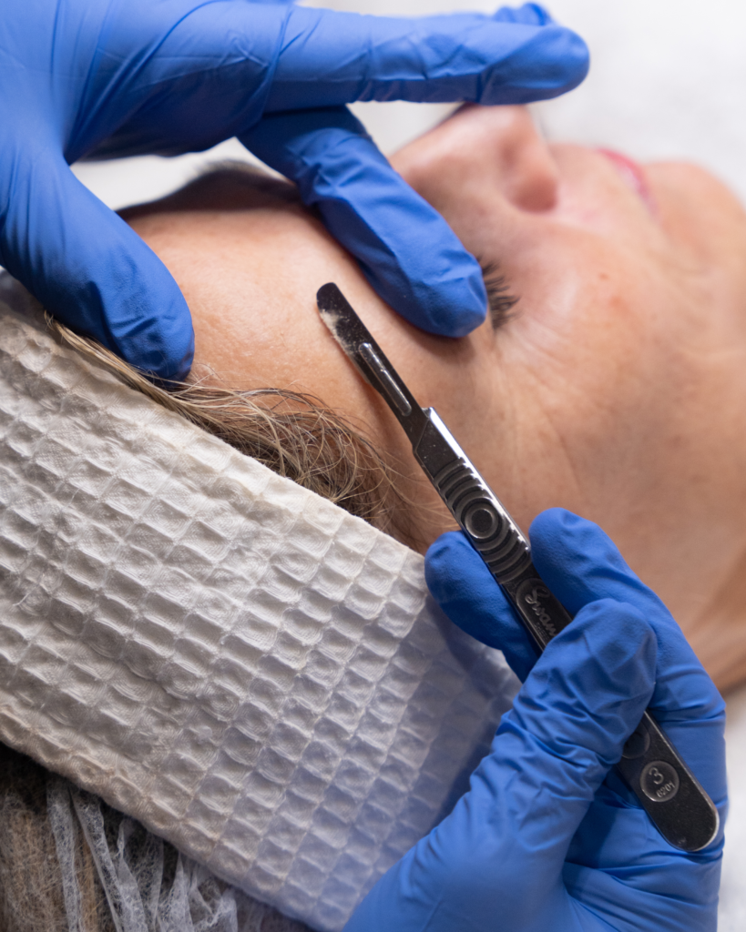 Dermaplaning - ProMD Health